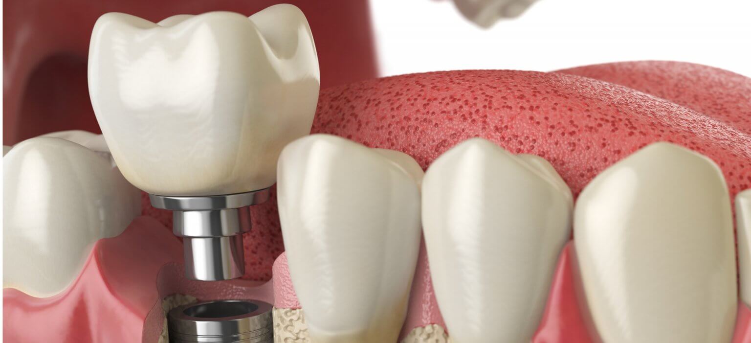 Authentic Dental Laboratory | Technology, Quality, and Service.